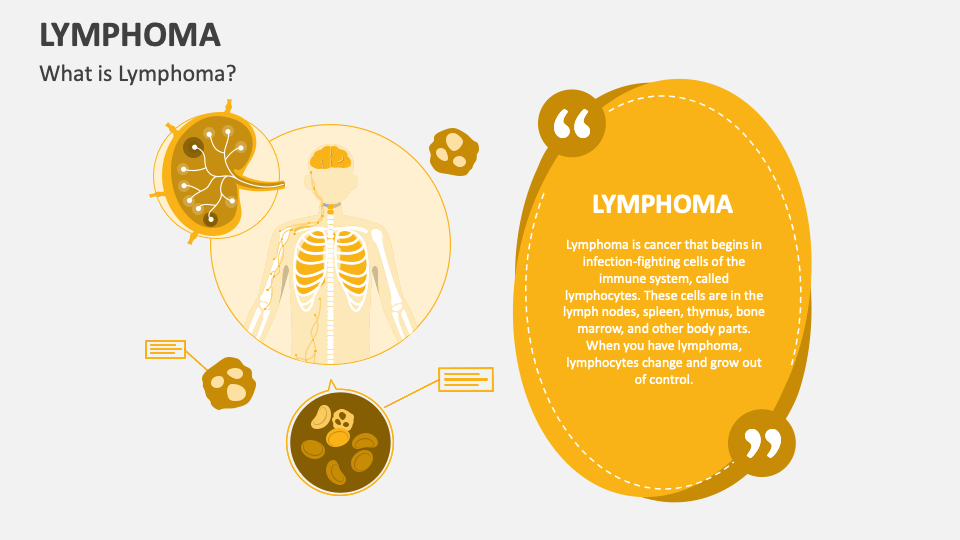 Lymphoma PowerPoint and Google Slides Template - PPT Slides