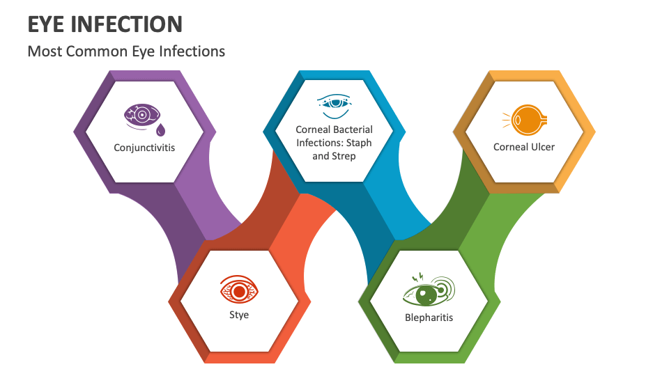 Eye Infection PowerPoint and Google Slides Template - PPT Slides