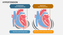 Hypertension PowerPoint and Google Slides Template - PPT Slides