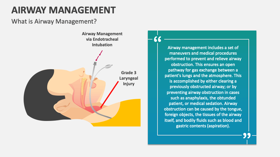 Airway Management PowerPoint and Google Slides Template - PPT Slides