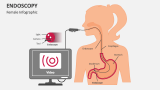 Endoscopy PowerPoint Presentation Slides - PPT Template