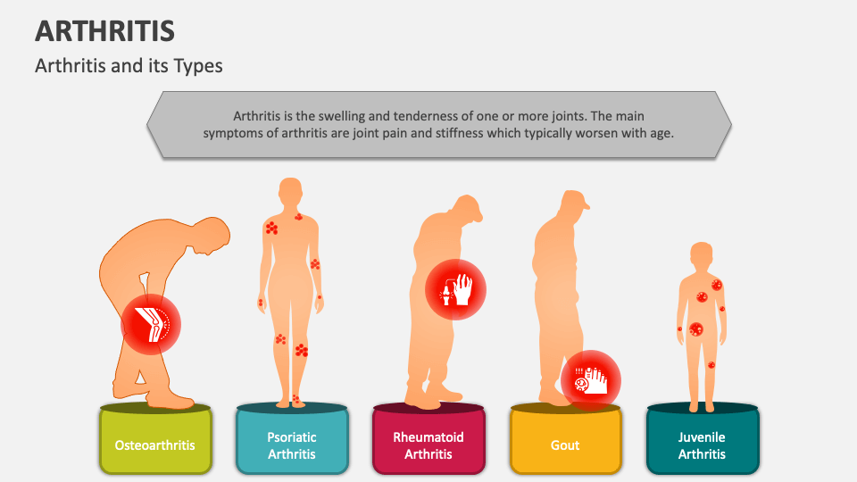 Arthritis PowerPoint and Google Slides Template - PPT Slides