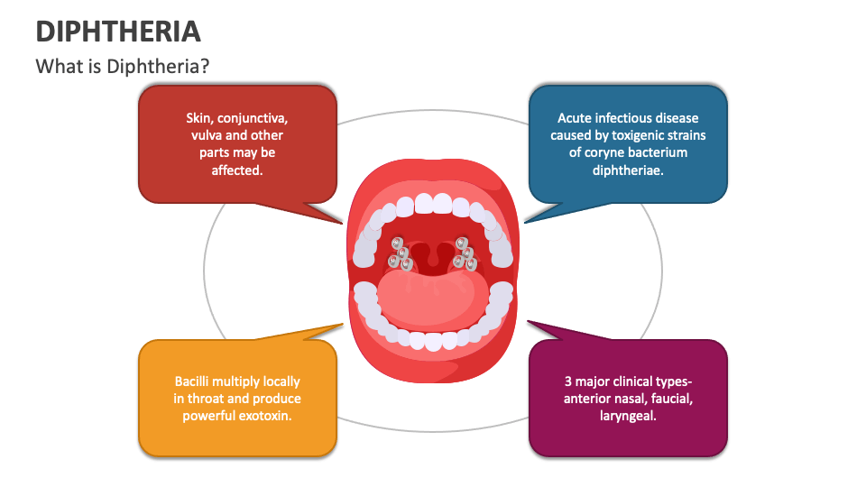 Diphtheria PowerPoint and Google Slides Template - PPT Slides