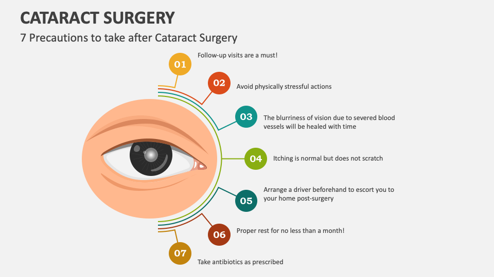 Cataract Surgery PowerPoint and Google Slides Template - PPT Slides