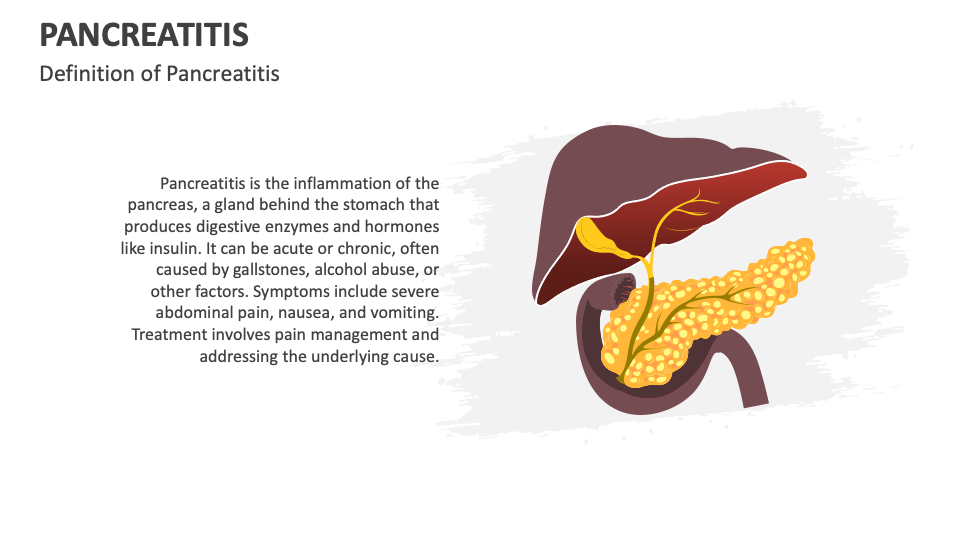 Pancreatitis PowerPoint and Google Slides Template - PPT Slides