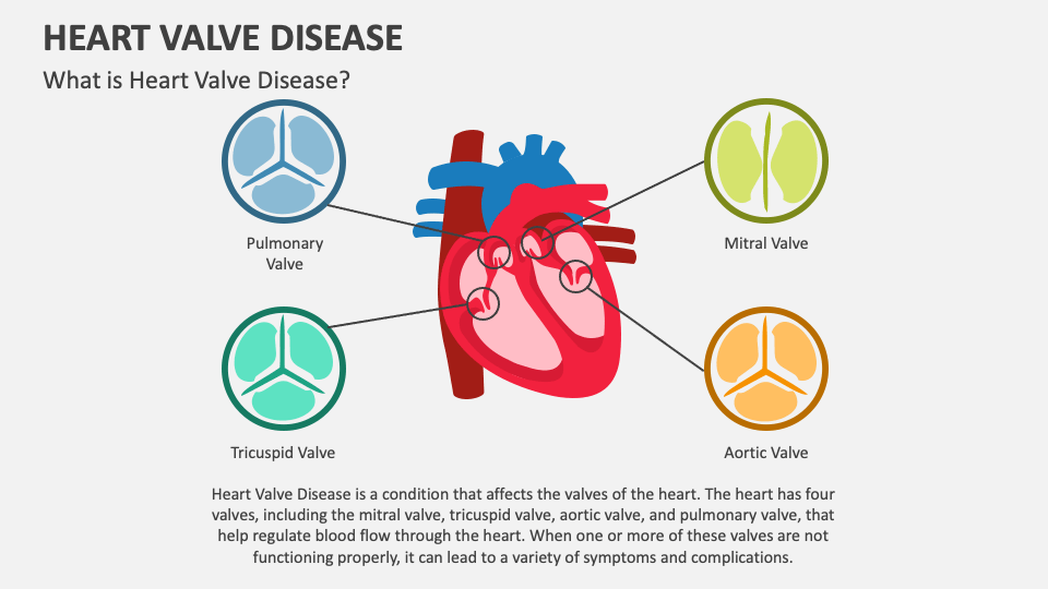 Anatomy Of Heart Valves Ppt