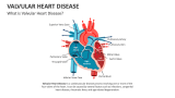 Valvular Heart Disease PowerPoint and Google Slides Template - PPT Slides