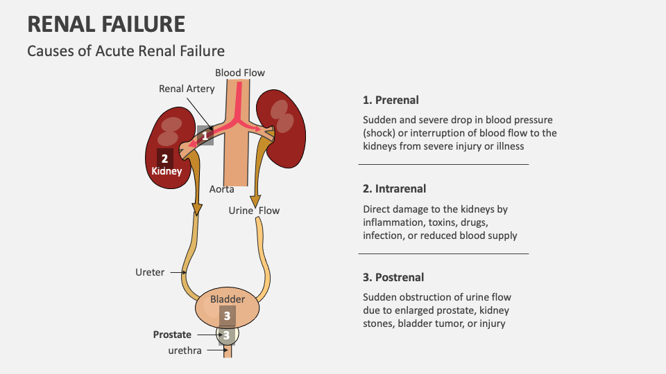 Renal Failure PowerPoint and Google Slides Template - PPT Slides