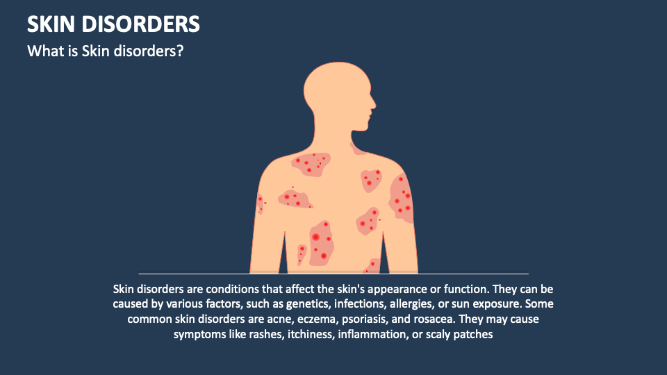 Skin Disorders PowerPoint and Google Slides Template - PPT Slides