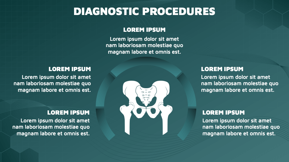 Free Medical Orthopedic Presentation Template for Google Slides and PowerPoint - PPT Slides