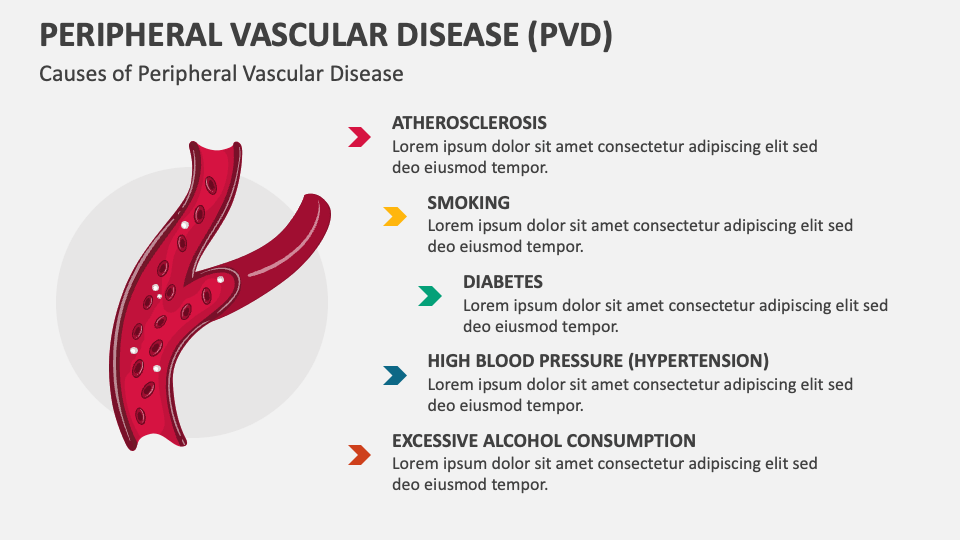 Peripheral Vascular Disease (PVD) Template for Google Slides and ...
