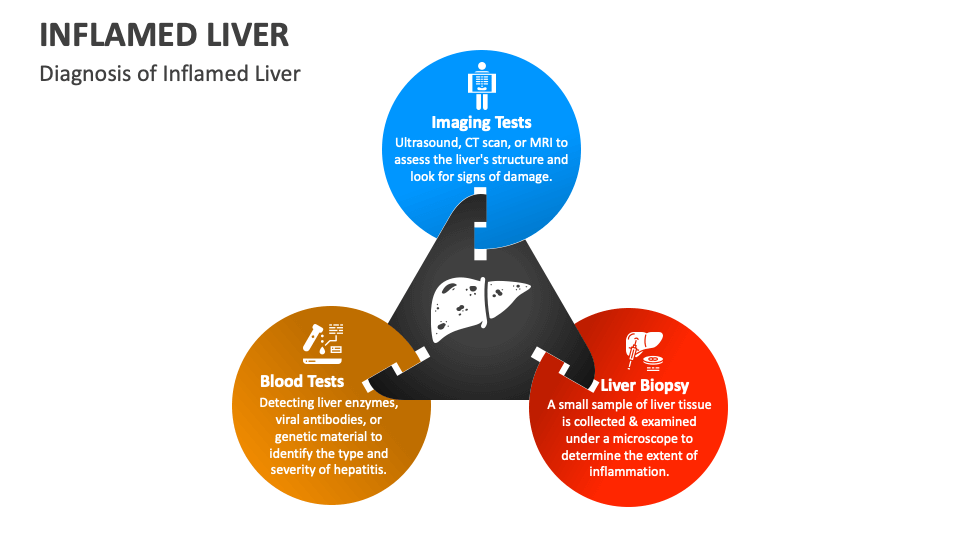 Inflamed Liver PowerPoint and Google Slides Template - PPT Slides