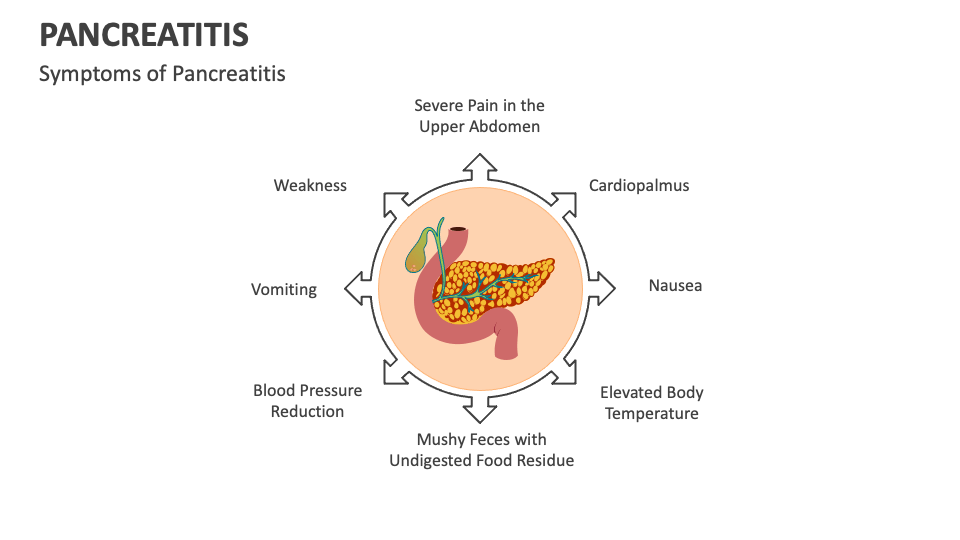 Pancreatitis PowerPoint and Google Slides Template - PPT Slides