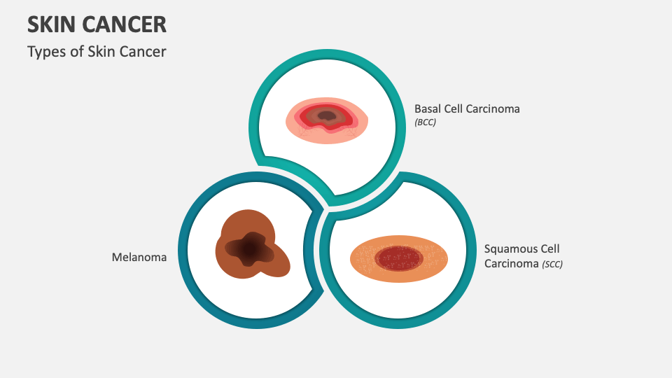 Skin Cancer PowerPoint and Google Slides Template - PPT Slides
