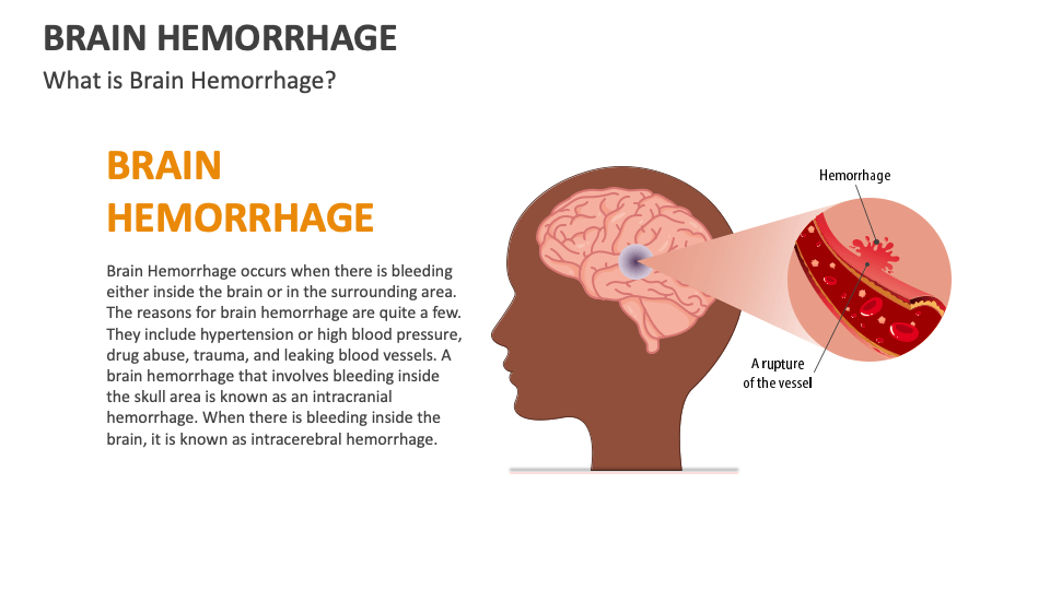 Intracranial Hemorrhage Pptx- Muhadharaty