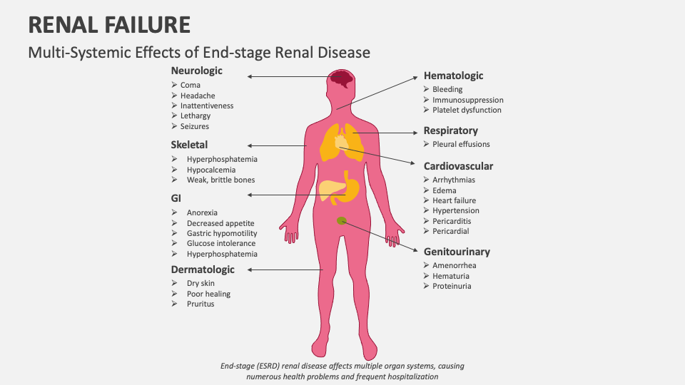 Renal Failure PowerPoint and Google Slides Template - PPT Slides