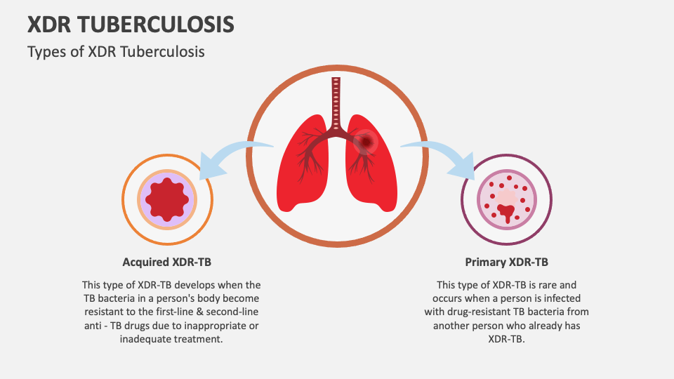 XDR Tuberculosis PowerPoint and Google Slides Template - PPT Slides